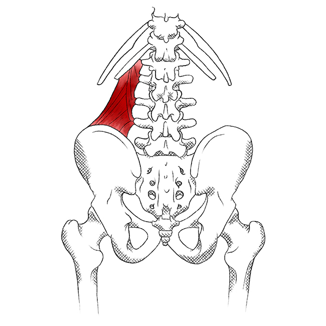 Músculo cuadrado lumbar: Dolores y puntos gatillo