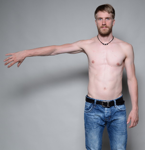 Músculo subclavio: Dolores y puntos gatillo